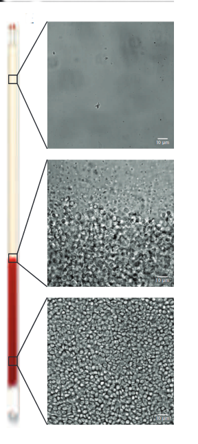 Paperfuge: A Paper Centrifuge for QBC Capillary Tubes | Lab On The Cheap